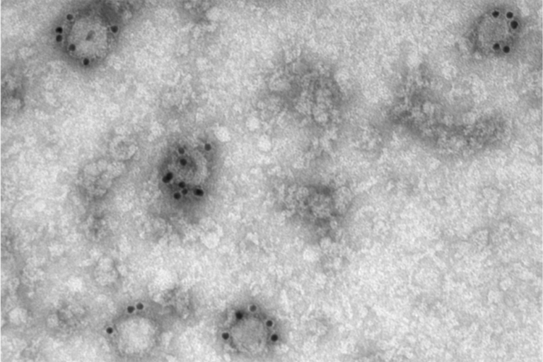 New vaccine platform could aid in fight against deadly viruses ...