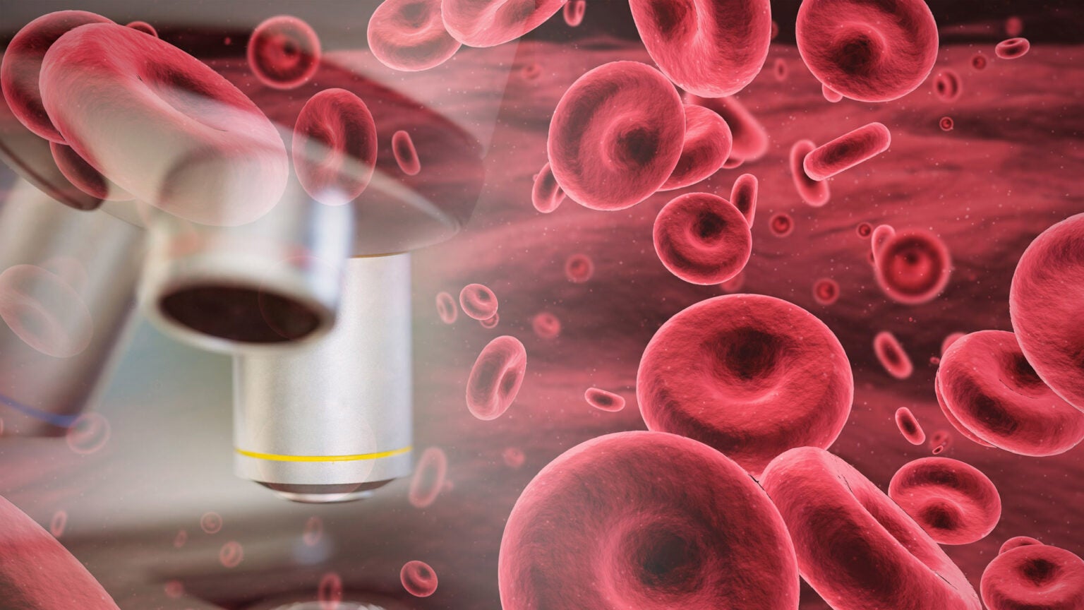 What to know about heme iron and diabetes risk | Harvard T.H. Chan ...