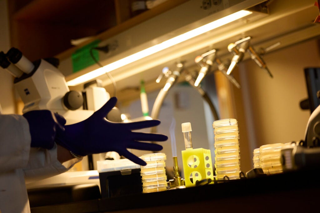 Overview | Department of Immunology and Infectious Diseases | Harvard T ...