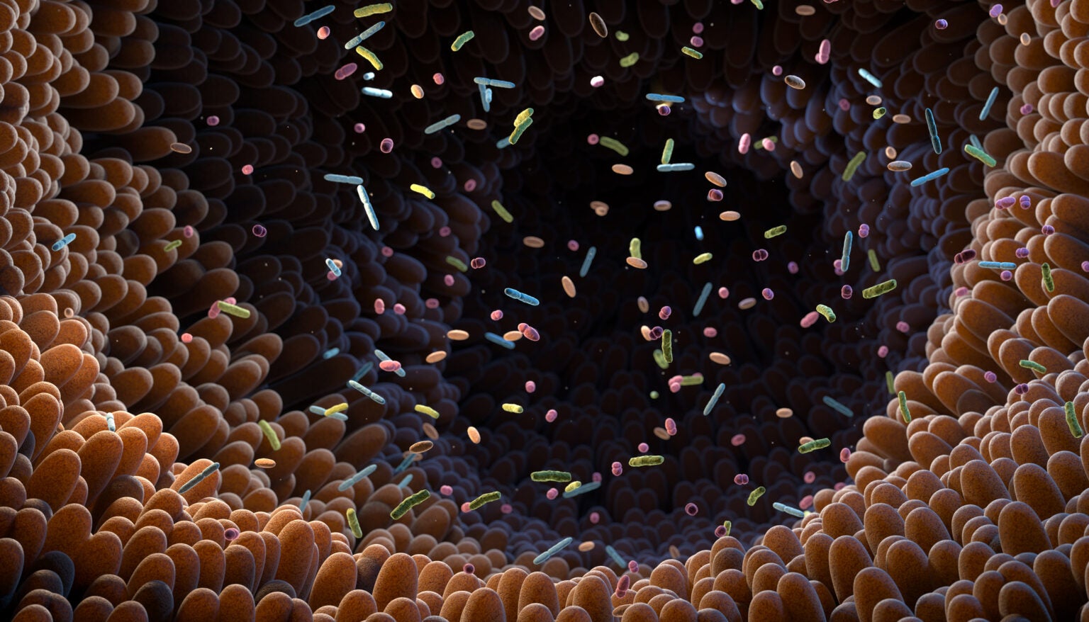 Colorectal cancer risk linked to gut microbiome alterations | Harvard T ...